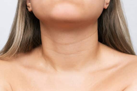 Necklace lines and Neck Bands Treatment | Boston, M