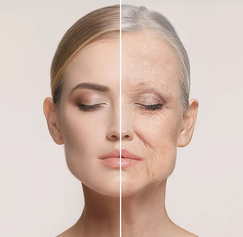 What to Expect With Laser Skin Resurfacing in Boston| Dr. Sean Doherty