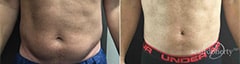 Plastic Surgeon Boston | Plastic Surgery Brookline, MA | Sean Doherty MD